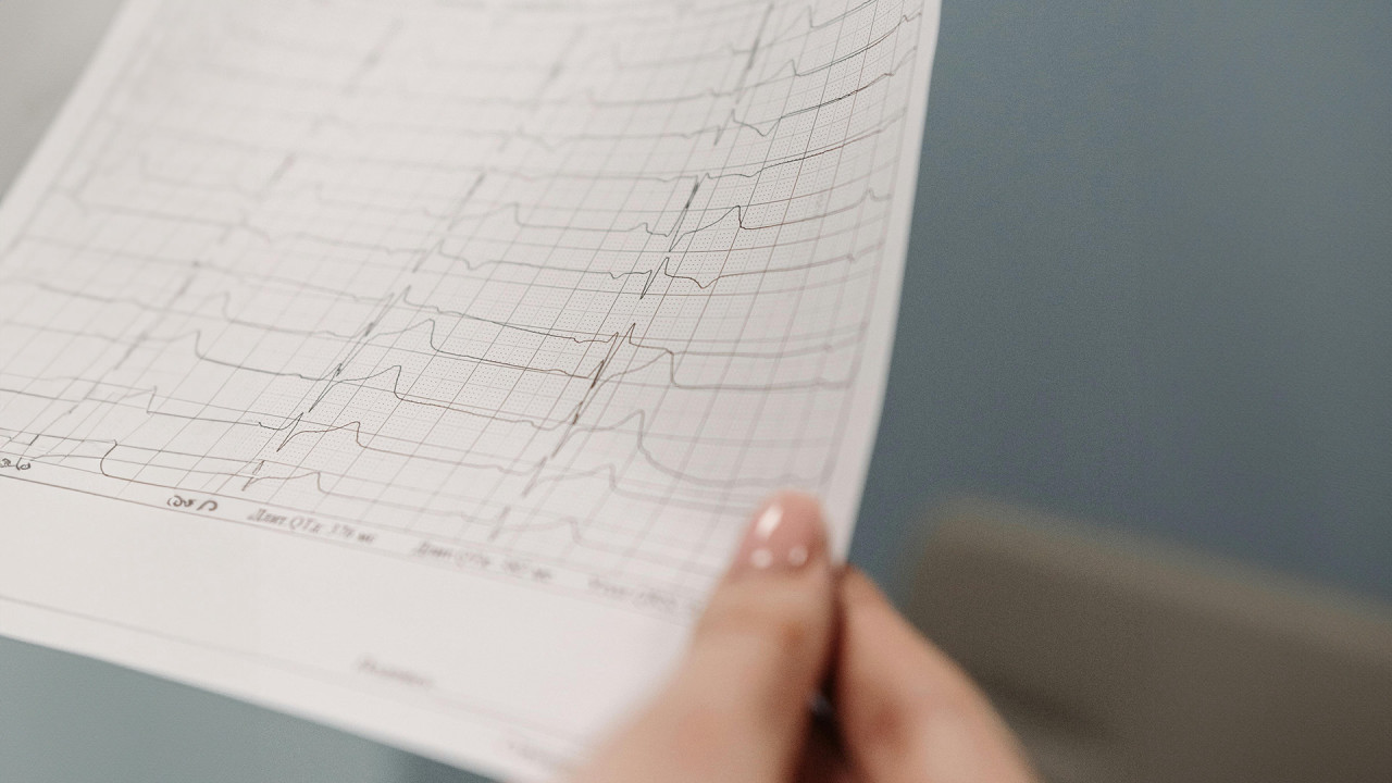 Facteurs de risques cardio-vasculaire pour médecin cardio-vasculaire